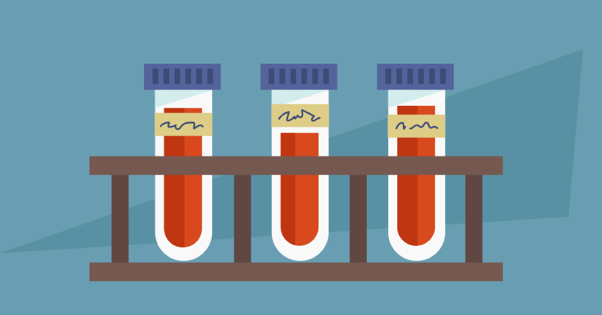 Viral Load Testing | HepatitisC.net